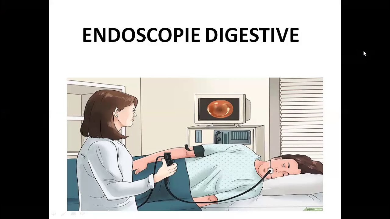 Endoscopie digestive - YouTube