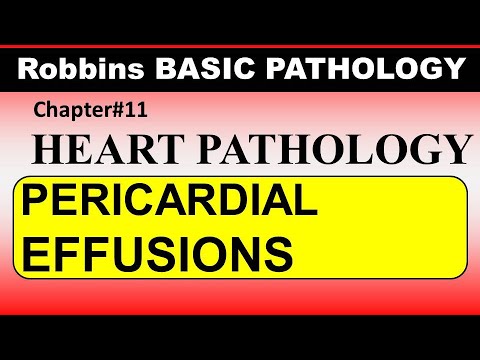 Chp#11 Robbins Patho | Heart Pathology | Pericardial Effusion | Dr Asif ...