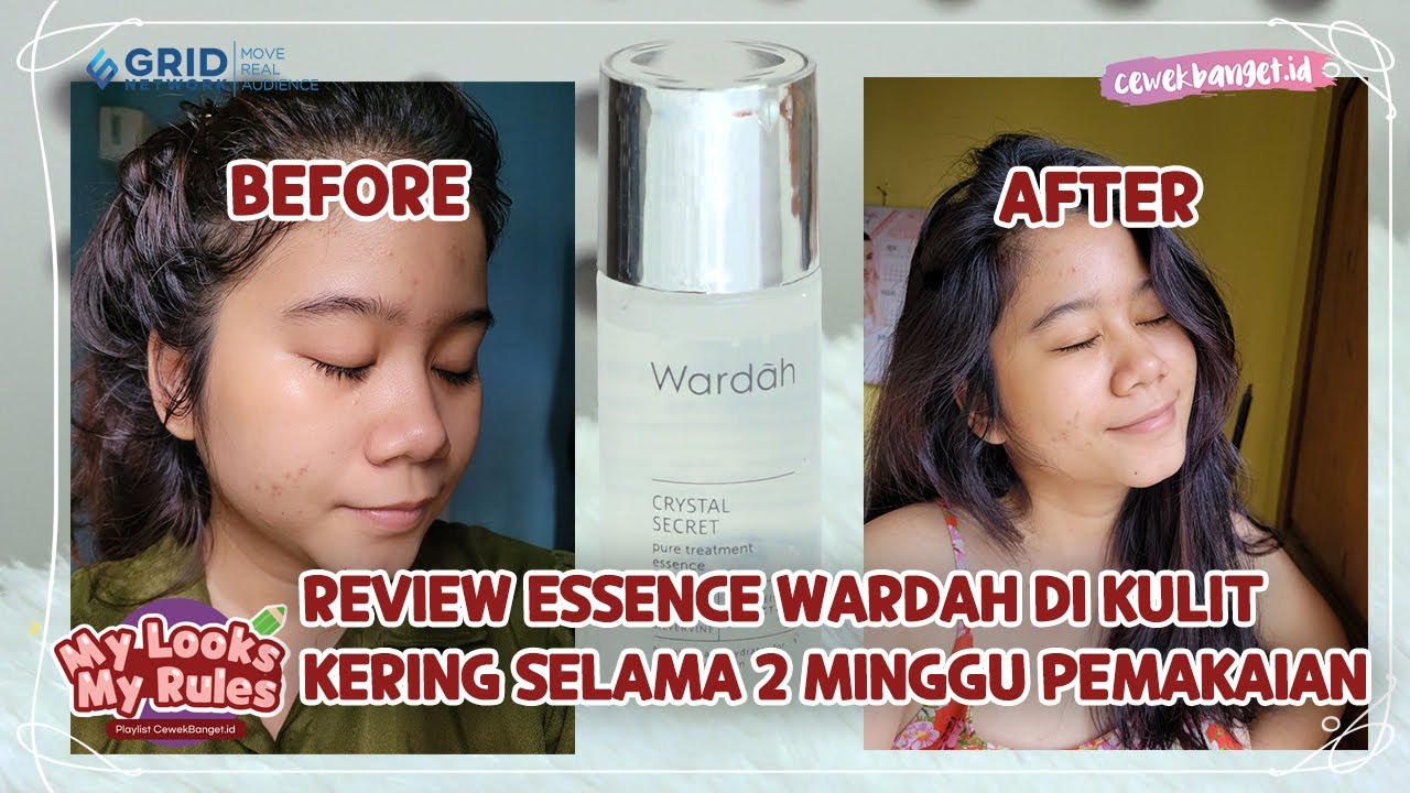 REVIEW WARDAH CRYSTAL SECRET PURE TREATMENT ESSENCE DI KULIT KERING ...