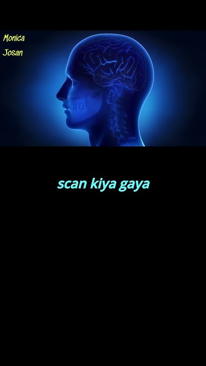 Case Study of HM Brain Hippocampus cortex lesions memory Epilepsy ...