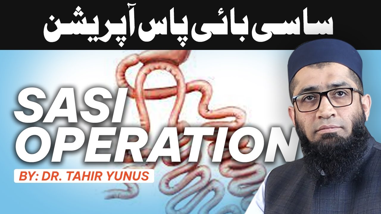 What Is SASI Surgery? Should This Operation Be done Or Not? | Dr. Tahir ...