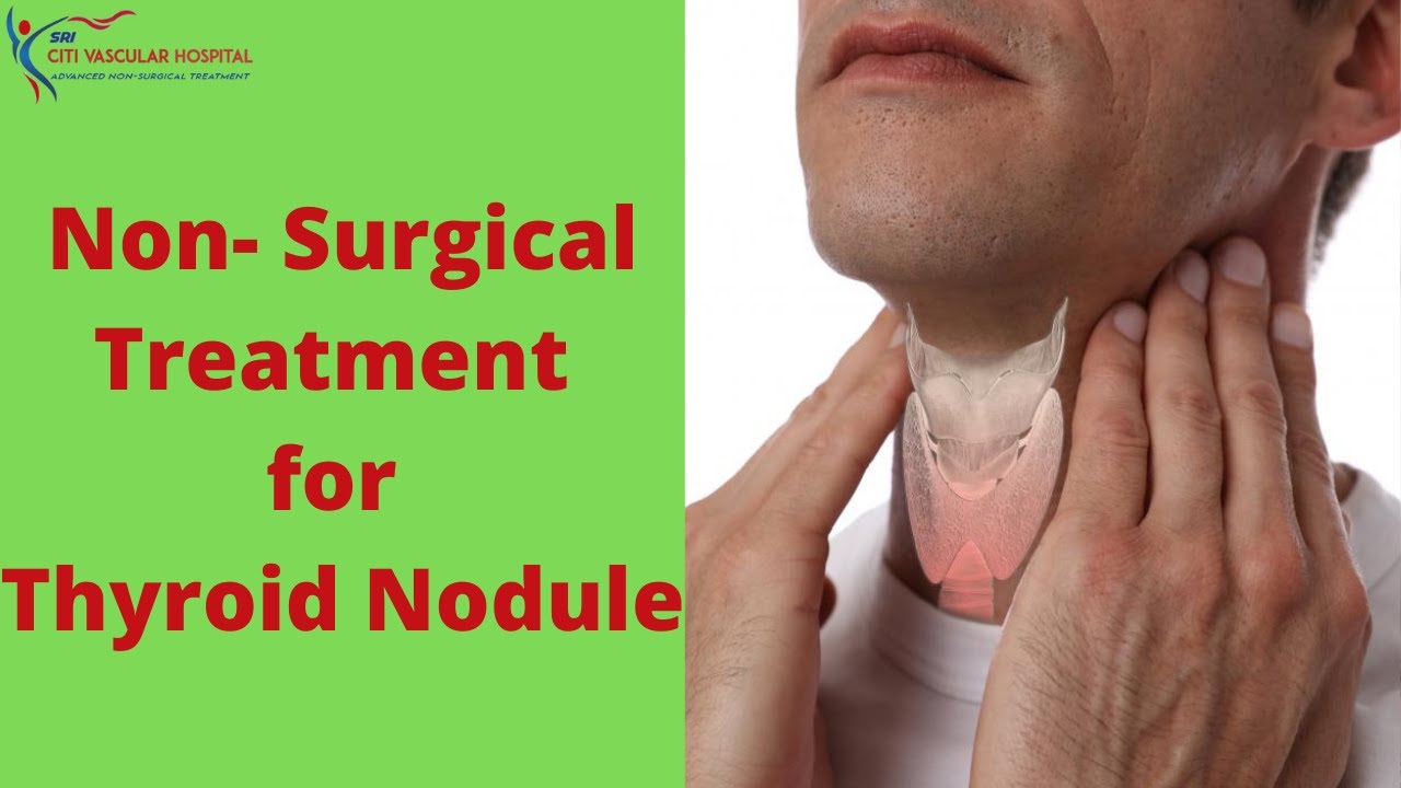 Thyroid Nodule Non Surgical Treatment For Thyroid Nodule By Thermal