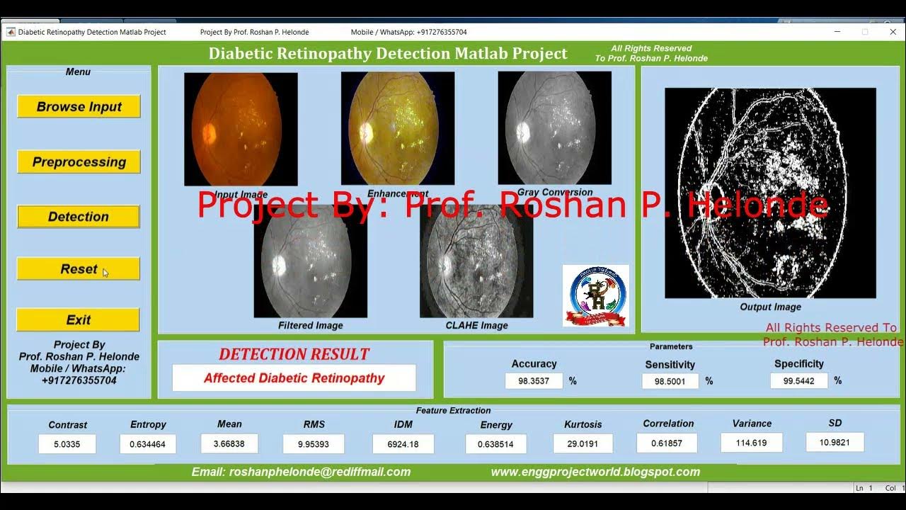 Diabetic Retinopathy Detection Image Processing Using Matlab Project| Final Year IEEE Project ...