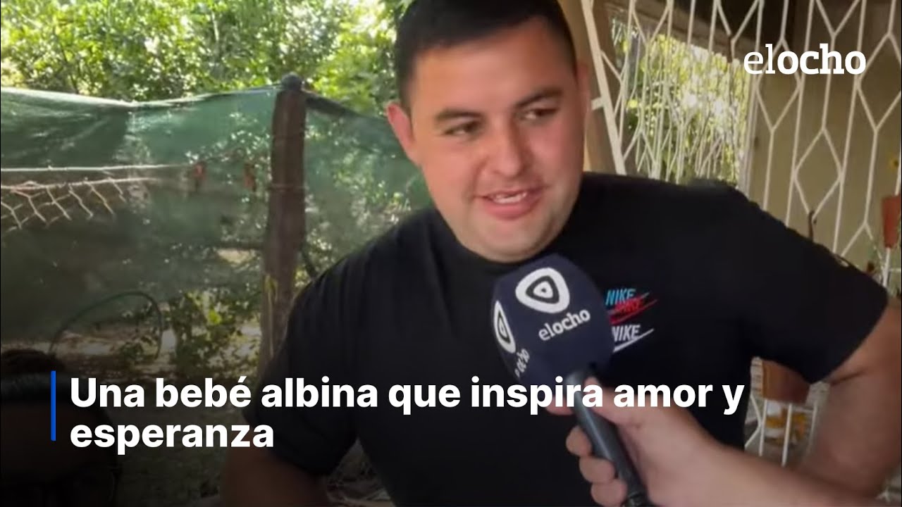 UNA BEBÉ ALBINA QUE INSPIRA AMOR Y ESPERANZA - YouTube