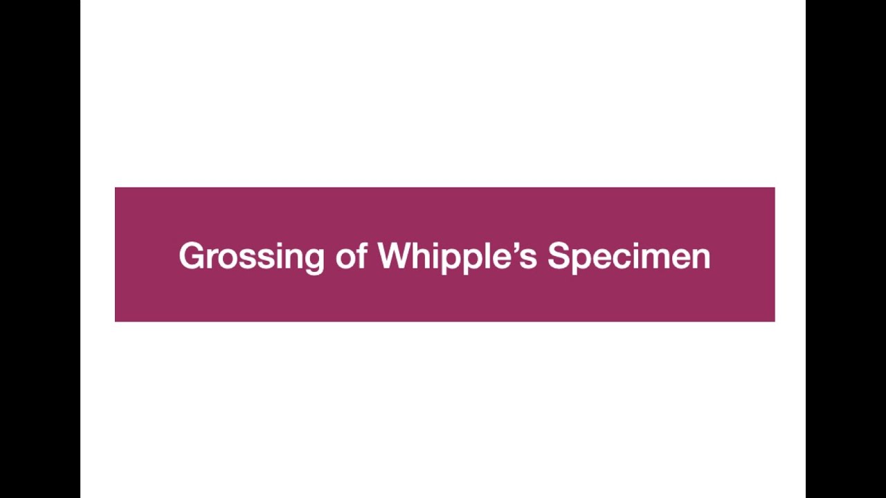 Grossing of Whipple's Specimen - YouTube