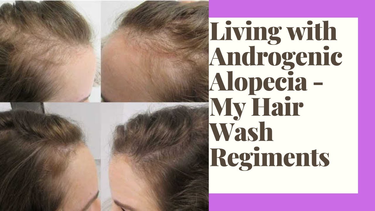 Living with Androgenic Alopecia - My Hair Wash Regimens - YouTube
