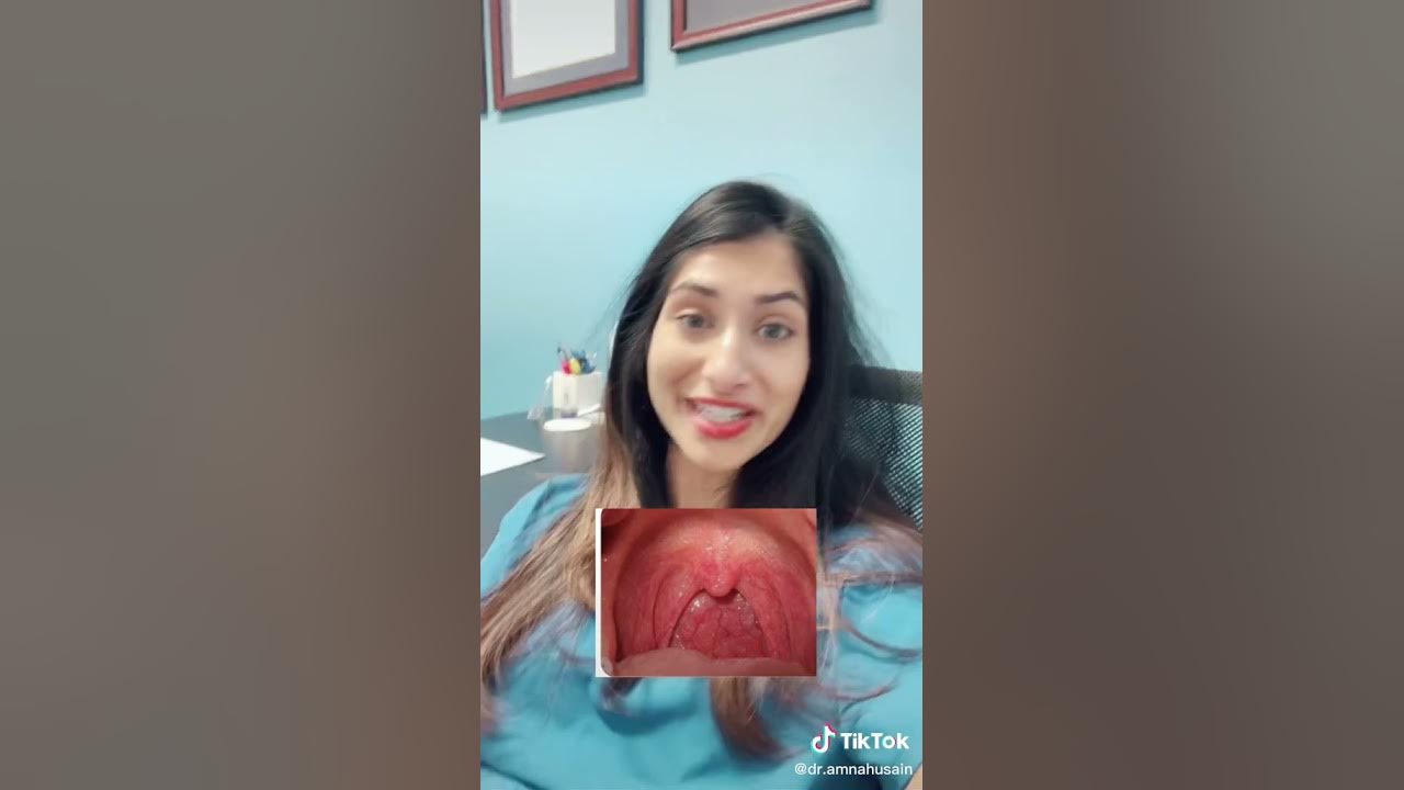 Pediatrician Breaks Down Viral Pharyngitis Dr Amna Husain Shorts Viralpharyngitis Youtube