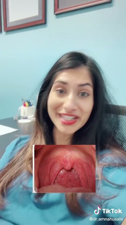 Pediatrician Breaks Down Viral Pharyngitis Dr Amna Husain Shorts Viralpharyngitis Youtube