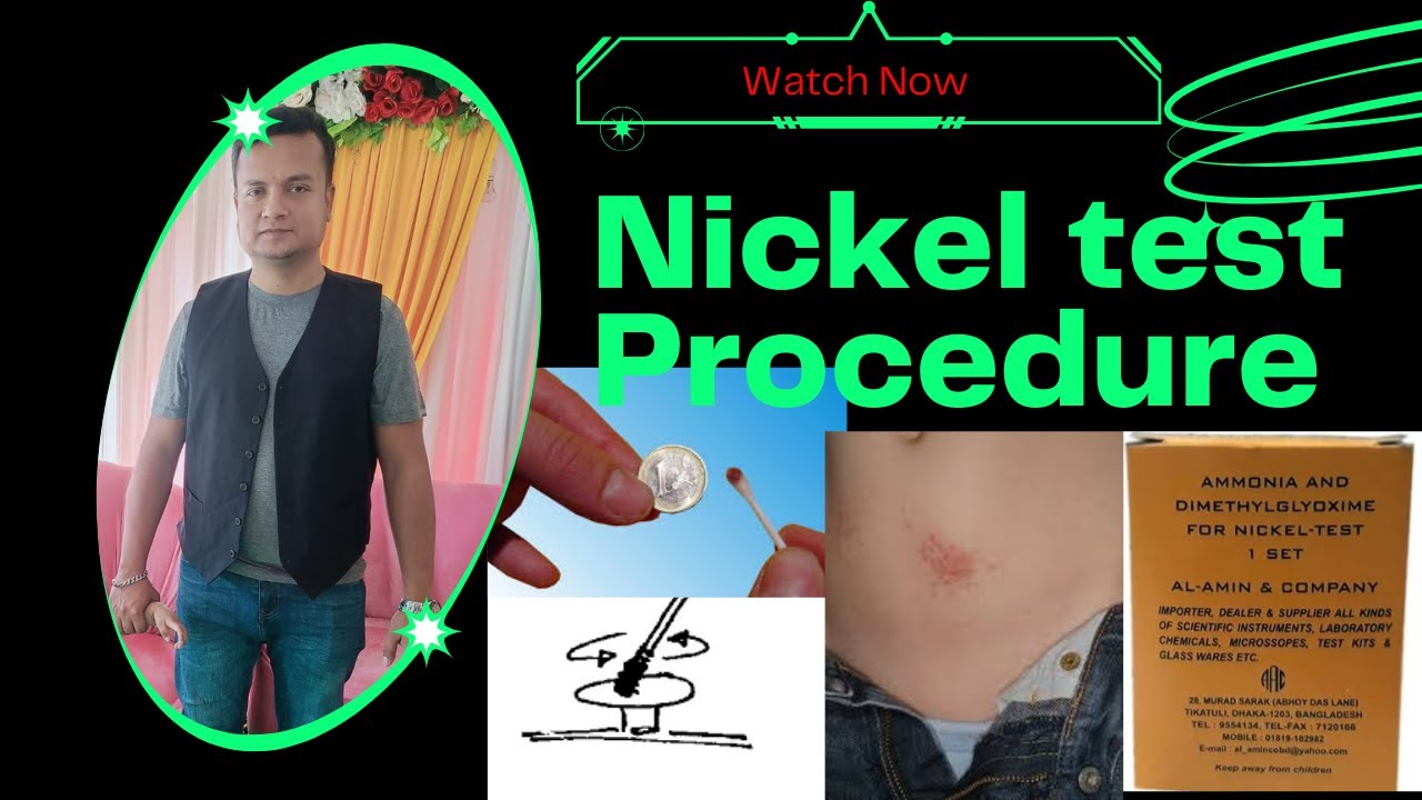 Nickel Test Procedure - YouTube