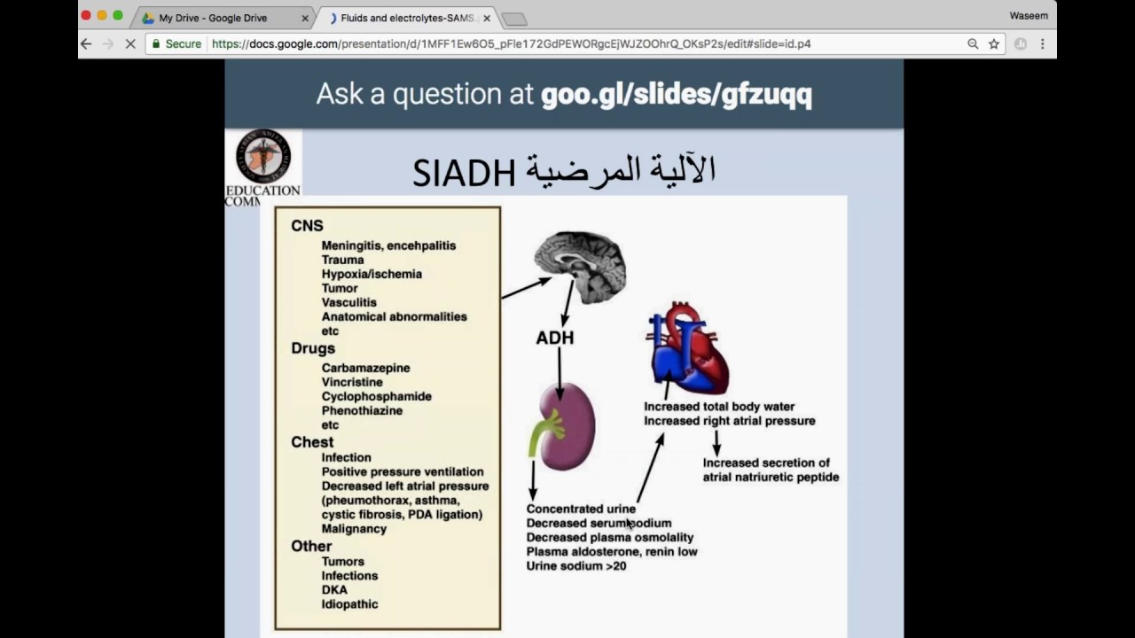 Pediatric Course | Fluids&Lytes- SIADH vs. DI vs. Cerebral Salt Wasting ...