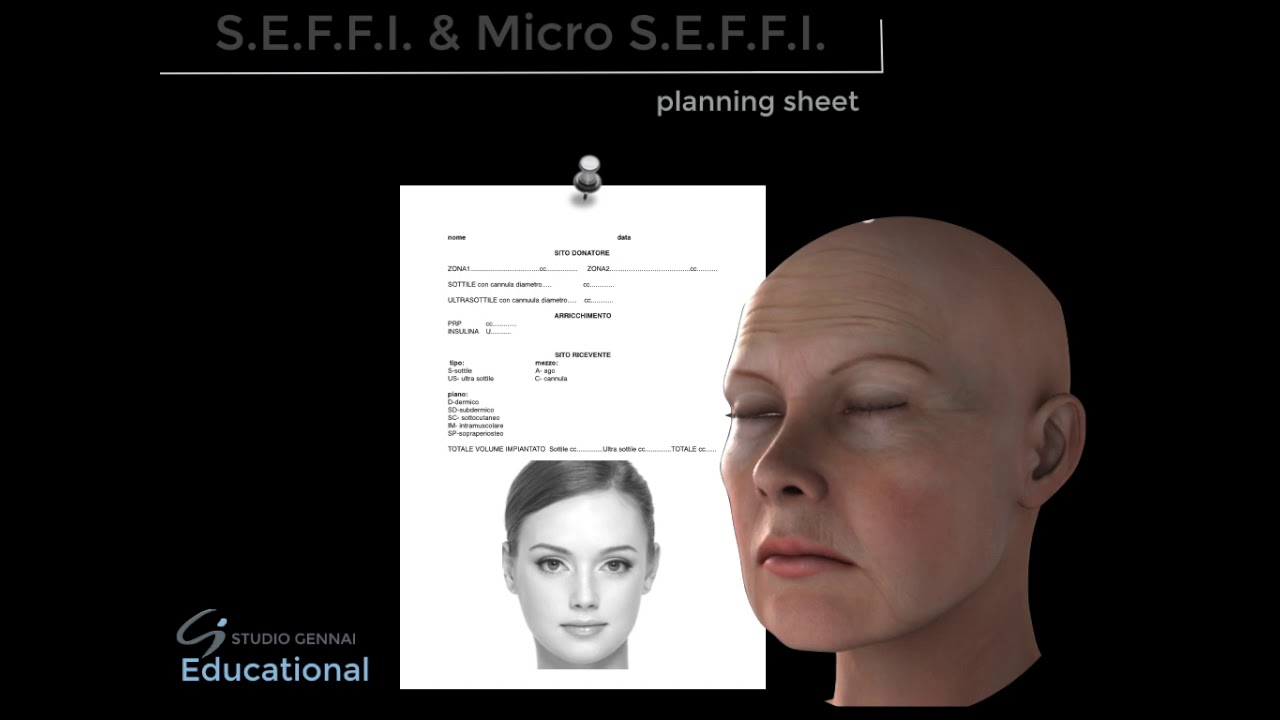 SEFFI and MicroSEFFI techniques - YouTube