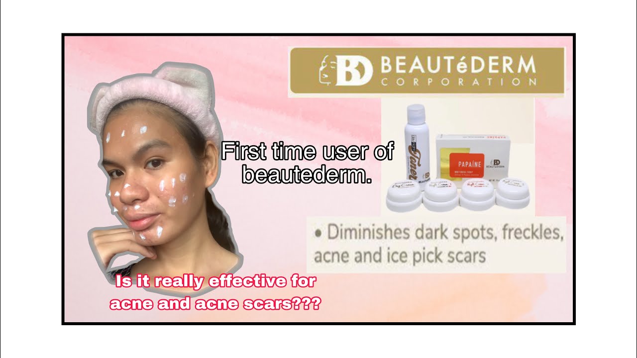 Beautederm | DIY TCA CROSS - Aftercare (Acne and Acne Scars Remedy ...