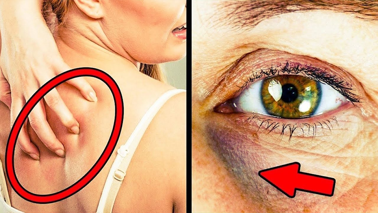 30 HEALTH HACKS EVERYONE SHOULD KNOW - YouTube