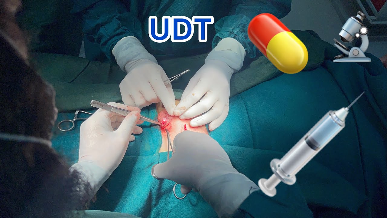 UDT/undescended testicle/cryptorchidism/#medicalstudent#information ...