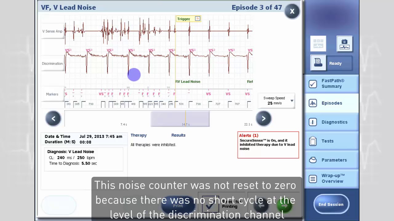 SecureSense 2 - YouTube