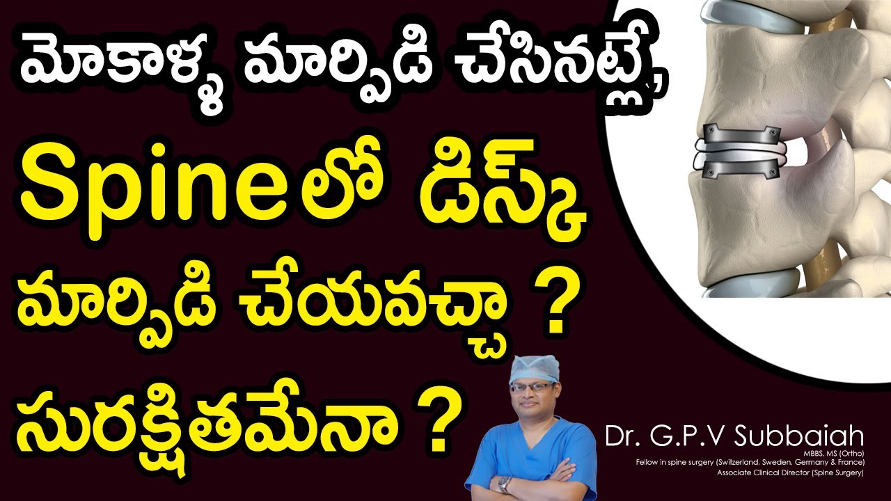 Disc replacement- indications & Contra-indications I spine surgery I ...