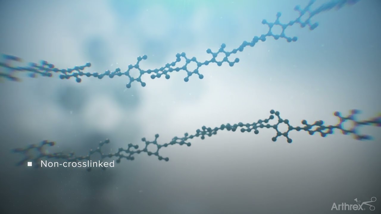 SynoJoynt™ 1% Sodium Hyaluronate - YouTube