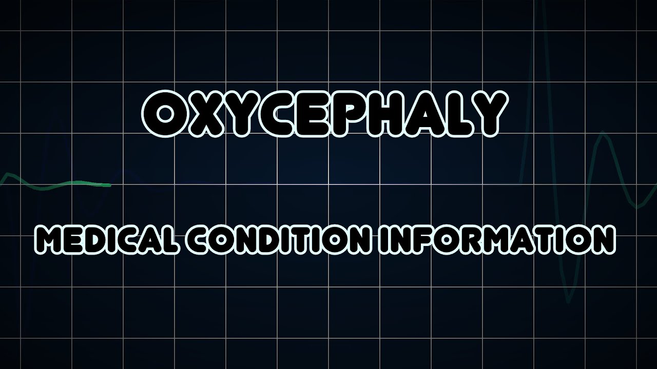 Oxycephaly (Medical Condition) - YouTube