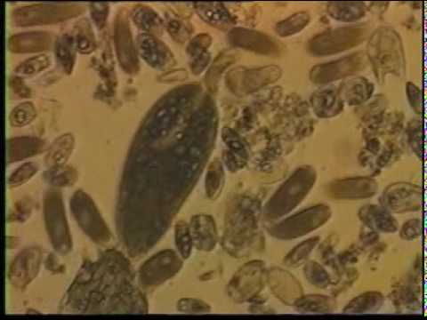 Rumen Protozoa.mpg - YouTube
