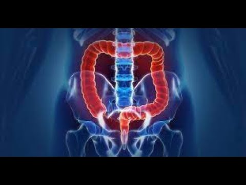 Modern Pharmaceutical Technologies for Drug Targeting A Review on Colon ...