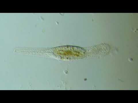 Ciliate from the North Sea: Uroleptus or Psammomitra