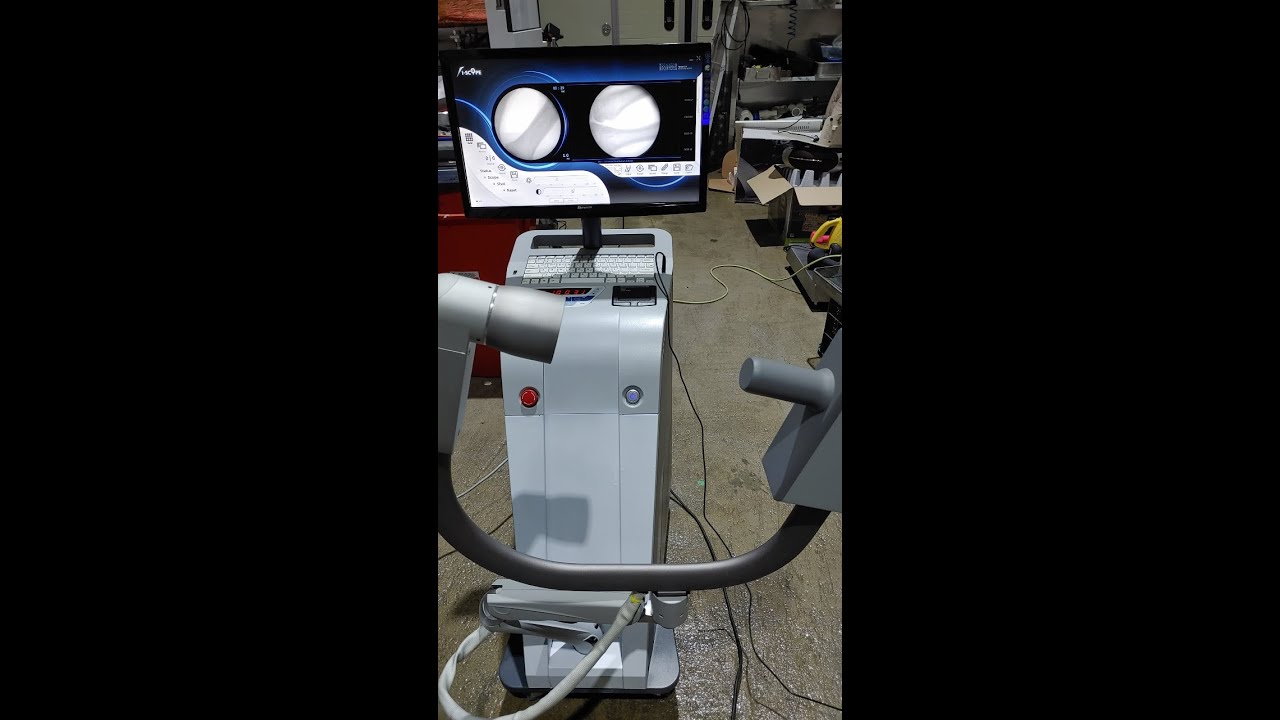 mini C- ARM I scope - YouTube