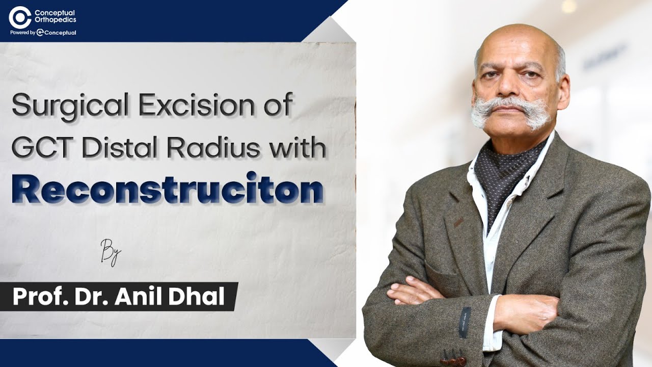 Surgical Excision of GCT Distal Radius With Reconstruction by prof. Dr. Anil Dhal - YouTube