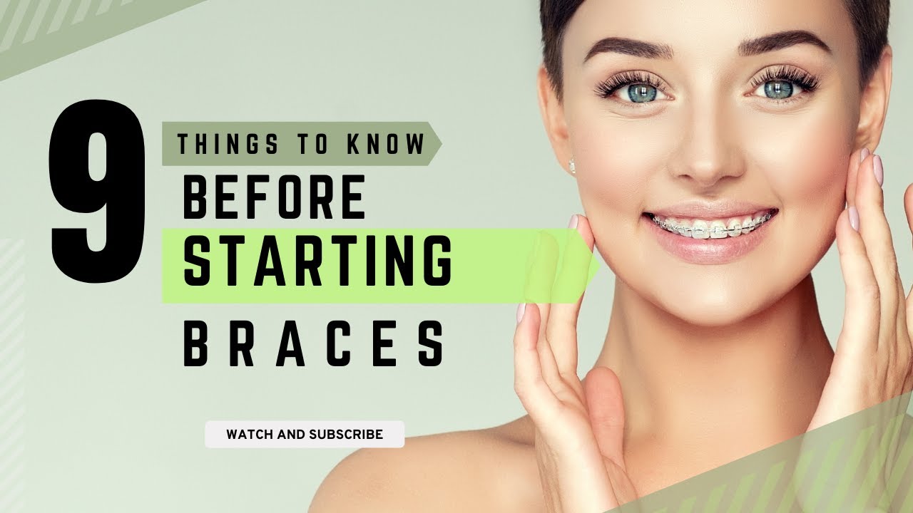 9 Things to Know Before Starting BRACES - YouTube