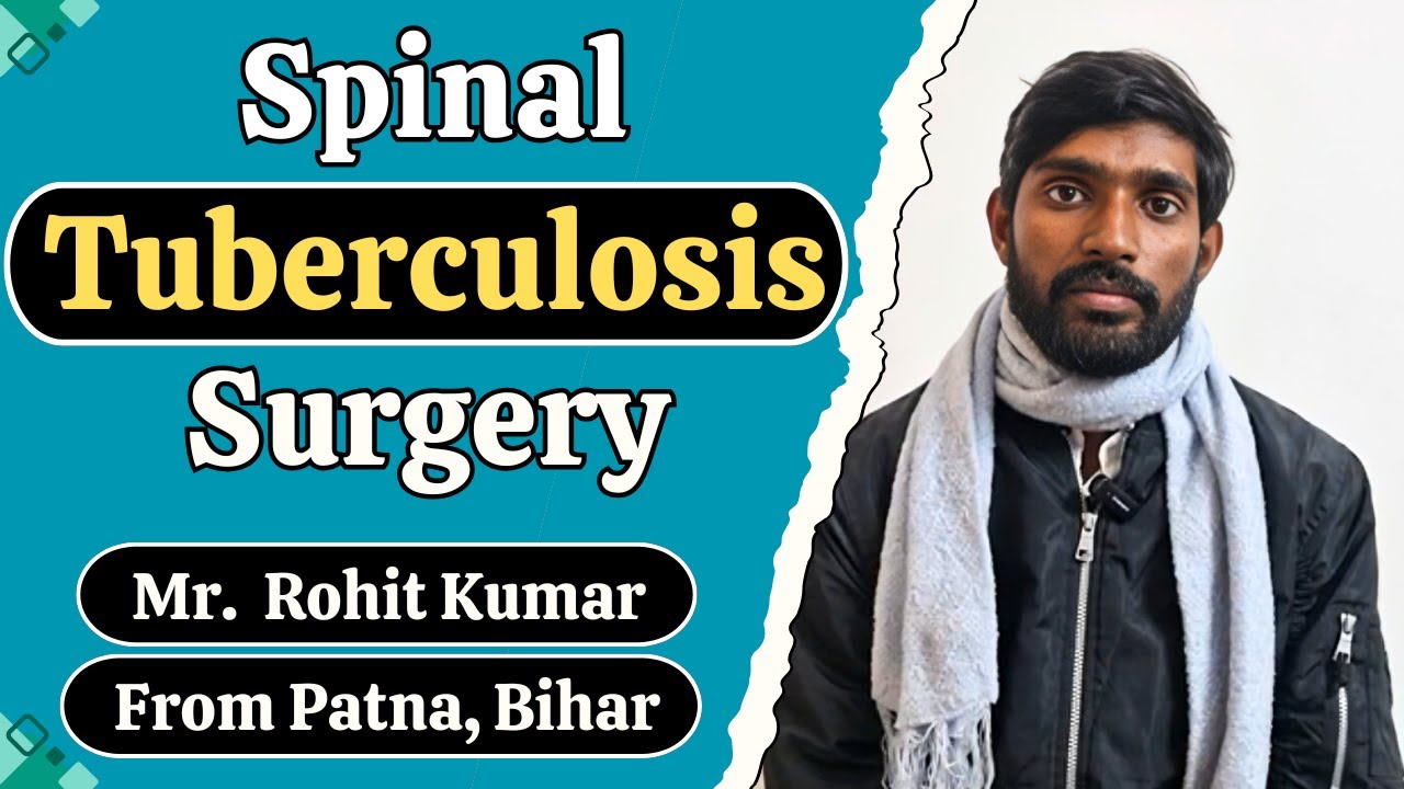Spinal Tuberculosis Surgery | Spinal TB Treatment in Delhi - YouTube