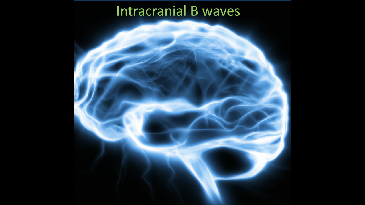 Intracranial B waves simulation - YouTube