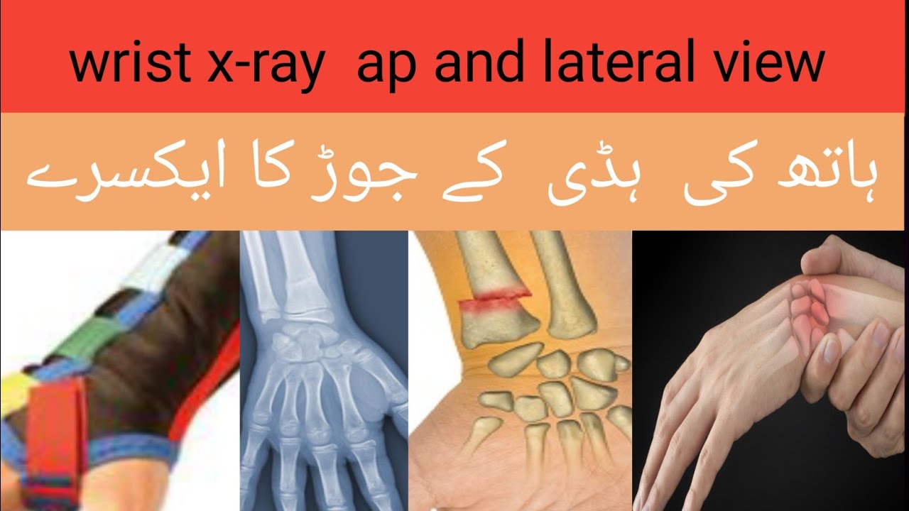 wrist x-ray and ap and lat view|hand bone x-ray |ہاتھ کی ہڈی کے جوڑ کا ...