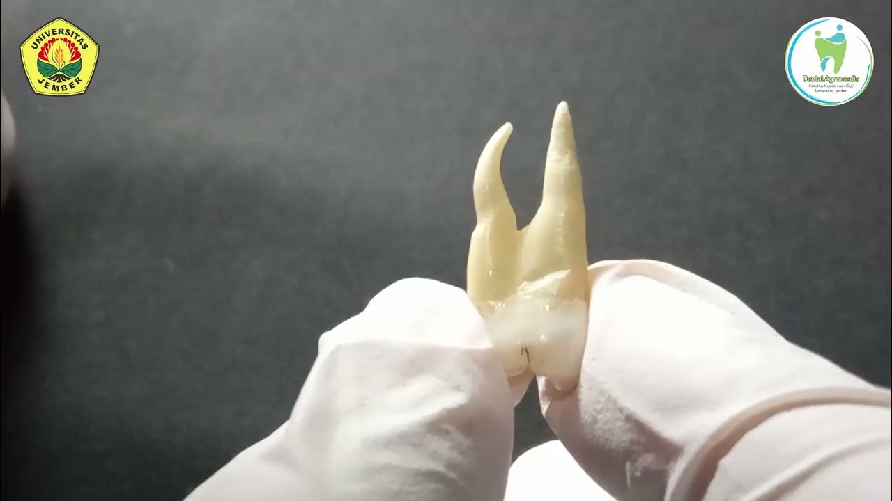 Anatomi Gigi Premolar permanen_Video Pembelajaran FKG UNEJ - YouTube