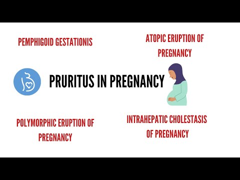 APPROACH TO PREGNANT WOMAN WITH PRURITUS | PEMPHIGOID GESTATIONIS | POLYMORPHIC ERUPTION | AEP | ICP