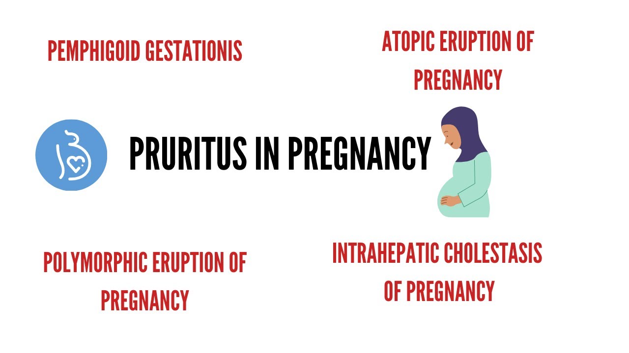 APPROACH TO PREGNANT WOMAN WITH PRURITUS | PEMPHIGOID GESTATIONIS ...
