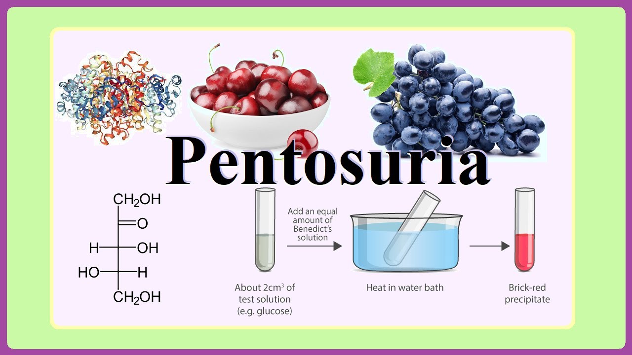 pentosuria - YouTube