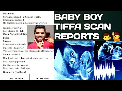 My Baby Boy TIFFA Scan Reports | Baby Ultrasound | Heart Rate| Placenta ...