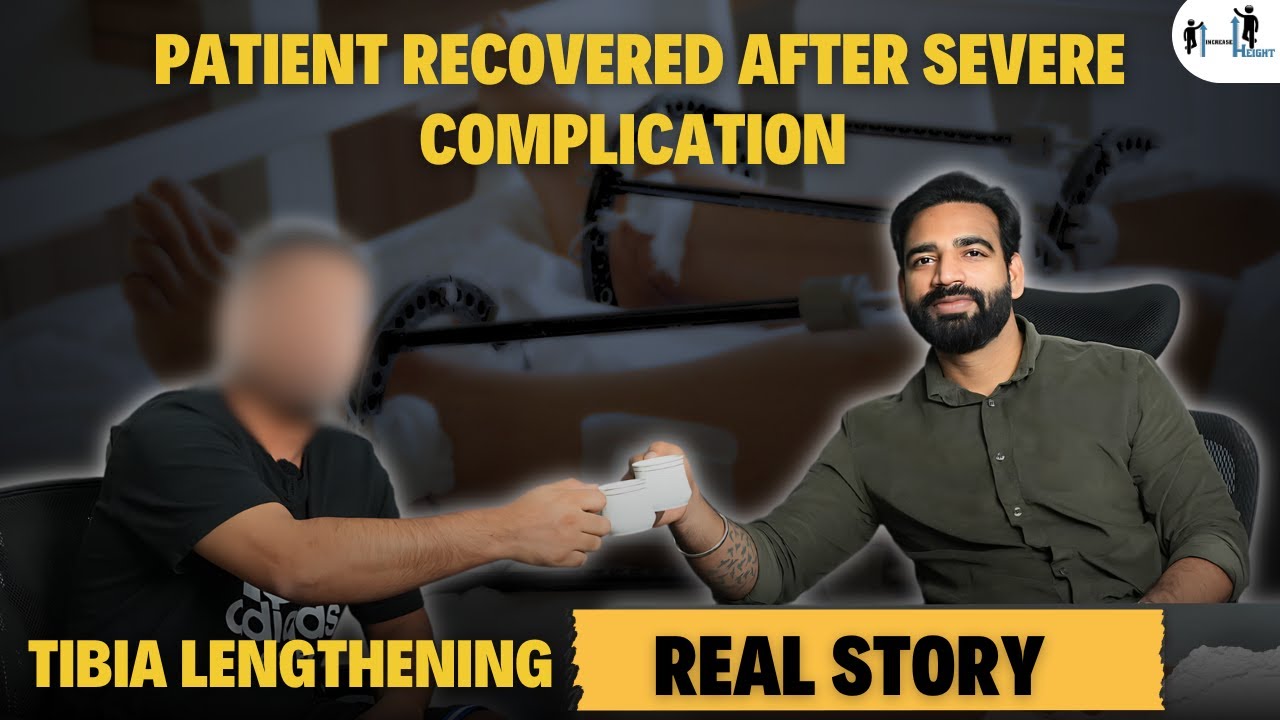 Real Story | Patient recovered after Severe Complication | Tibia ...