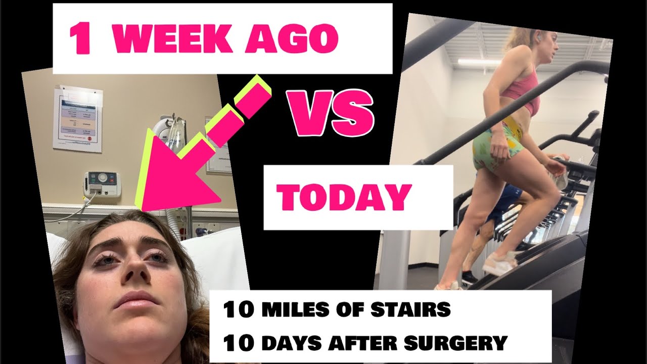 How I Did 10 Miles of Stairs 10 DAYS After Surgery - YouTube