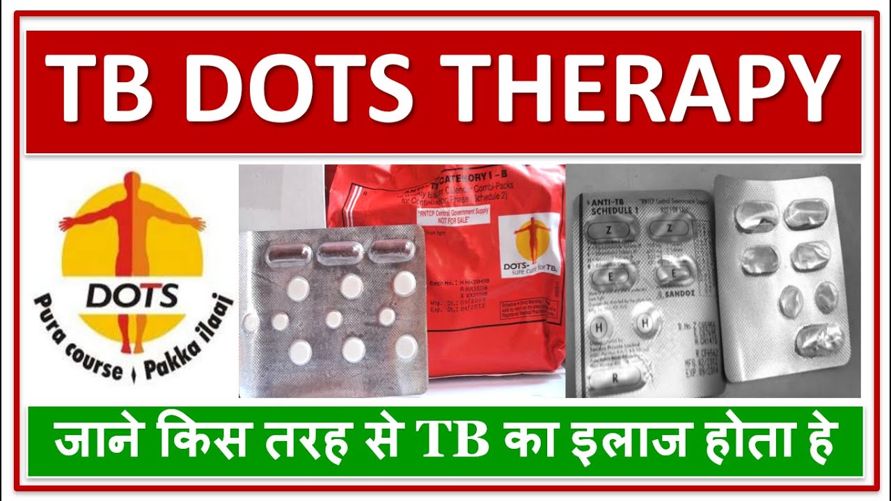 TB DOTS THERAPY TB tb-dots-therapy-tb
