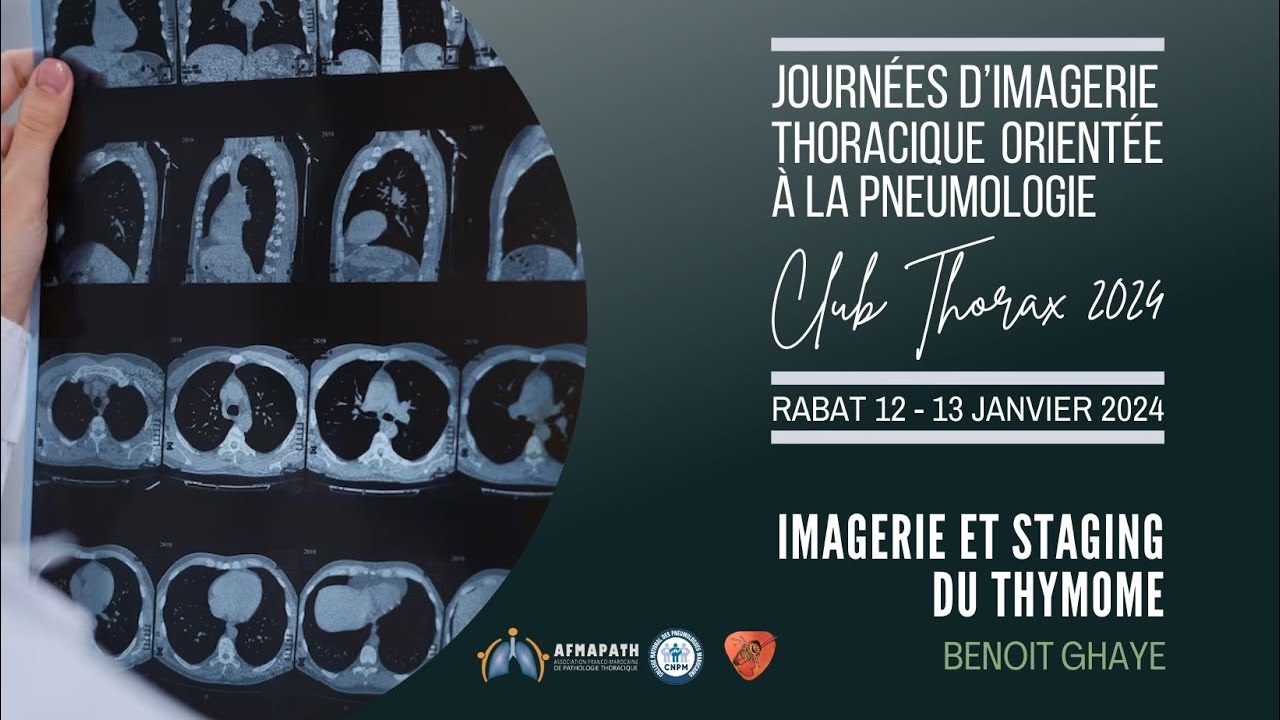 Imagerie et staging du thymome. Benoît Ghaye - YouTube