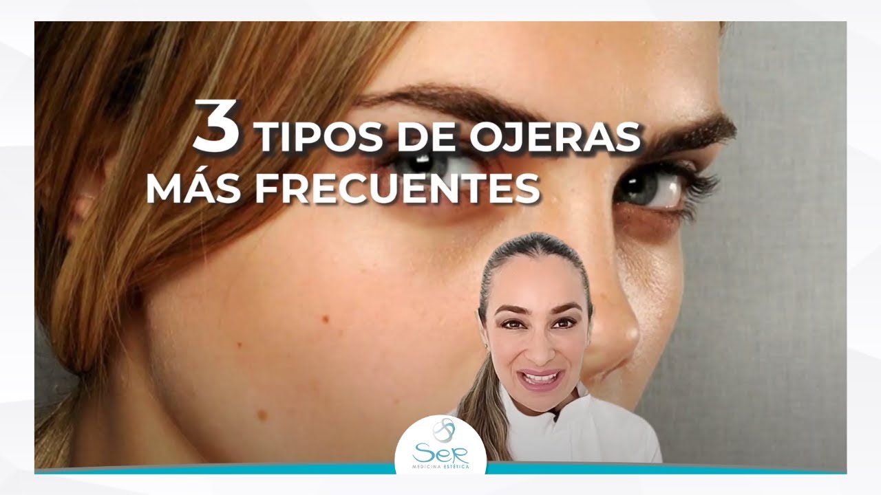 QUÉ TIPO DE OJERA TENGO | Aprende a diagnósticarla y tratarla - YouTube