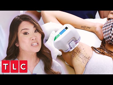 Extreme Hyperhidrosis: Dr. Lee Treats Patient's Uncontrollable Sweating | Dr. Pimple Popper
