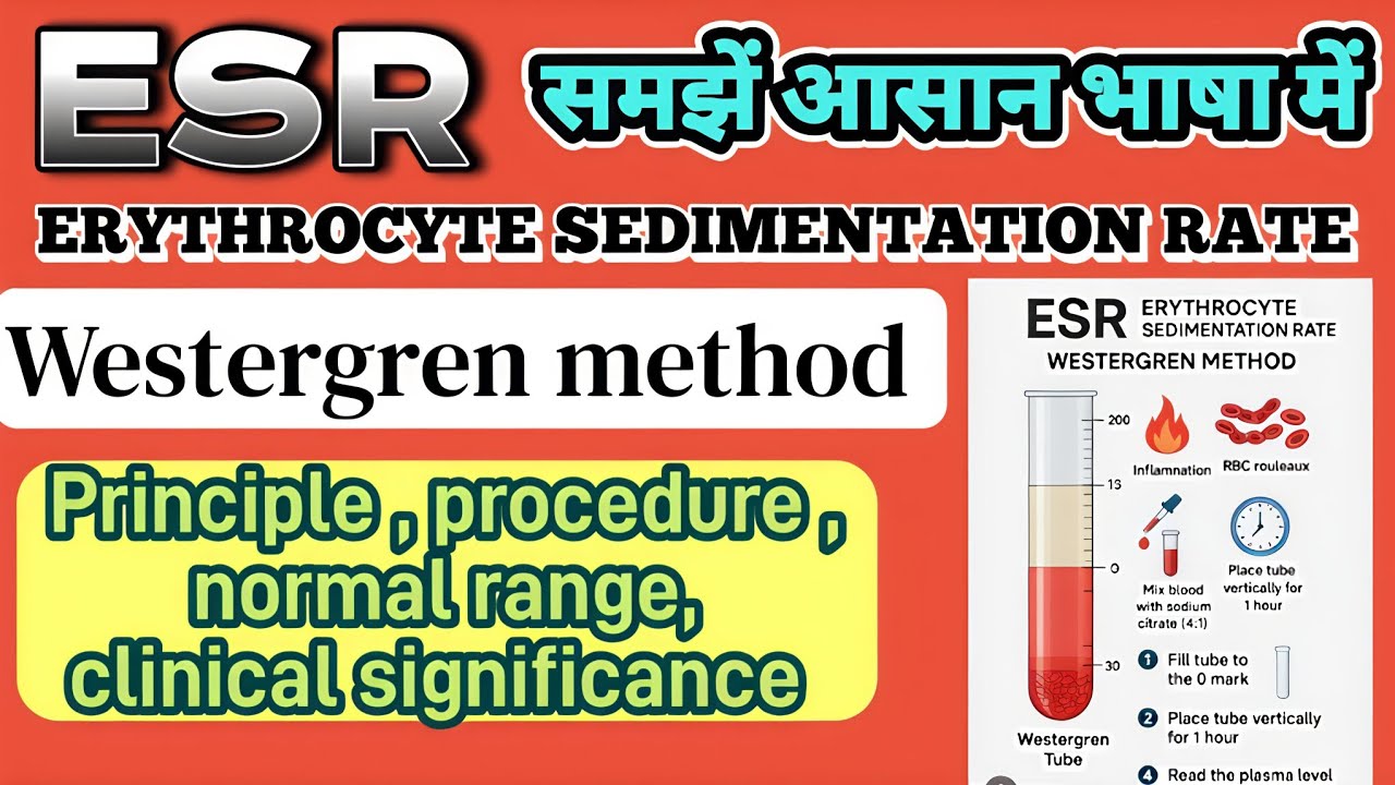 ESR Test in Hindi | Erythrocyte Sedimentation Rate | Principal ...