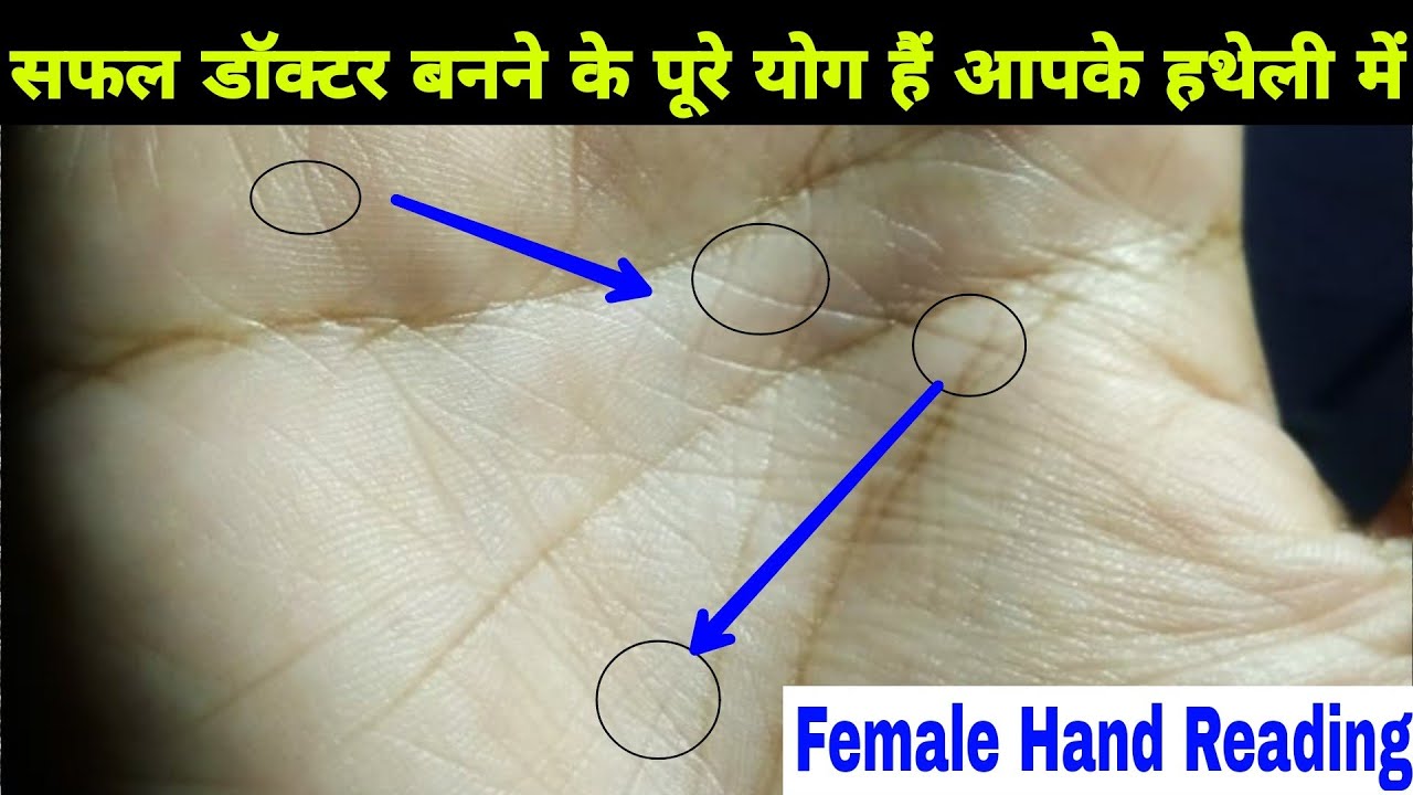 female hand reading - सफल डॉक्टर बनने के पूरे योग हैं आपके हथेली में ...