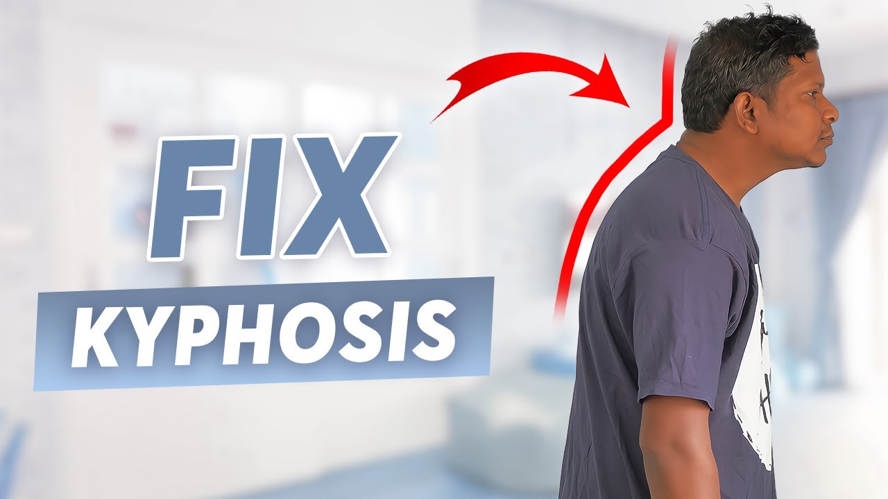 Fix Hunch Back! 6 Easy Kyphosis Correction Exercises at Home| कूबड़पन ...