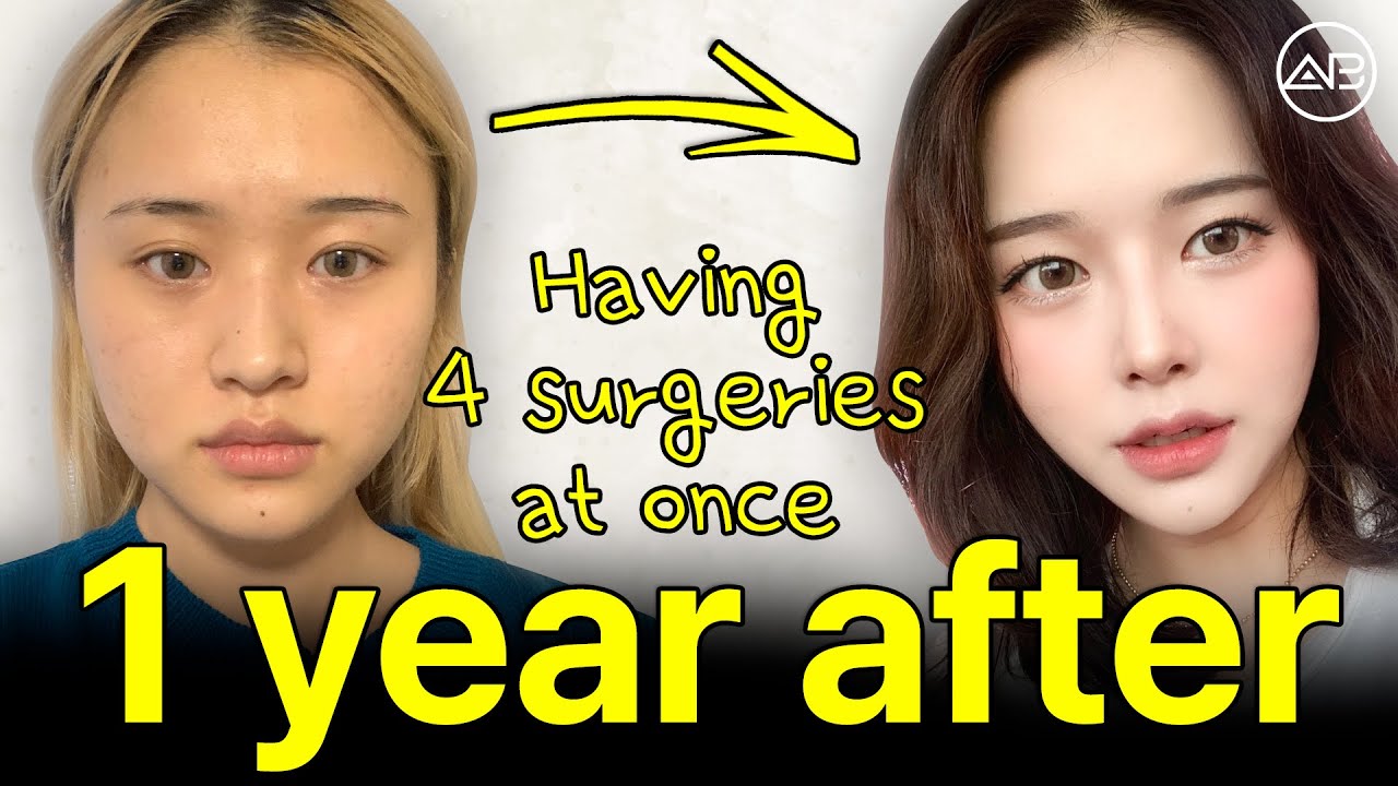 Review of My Plastic Surgery One Year Later | Starlight | AB Plastic ...