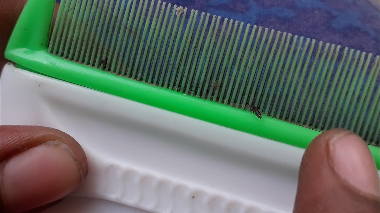 Real sounds Sister hair Self Comb Nitpicking/heavy nits in hair/in ...