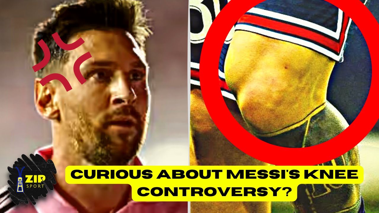 What's the Mystery Behind Lionel Messi's Unusual Knees? - YouTube