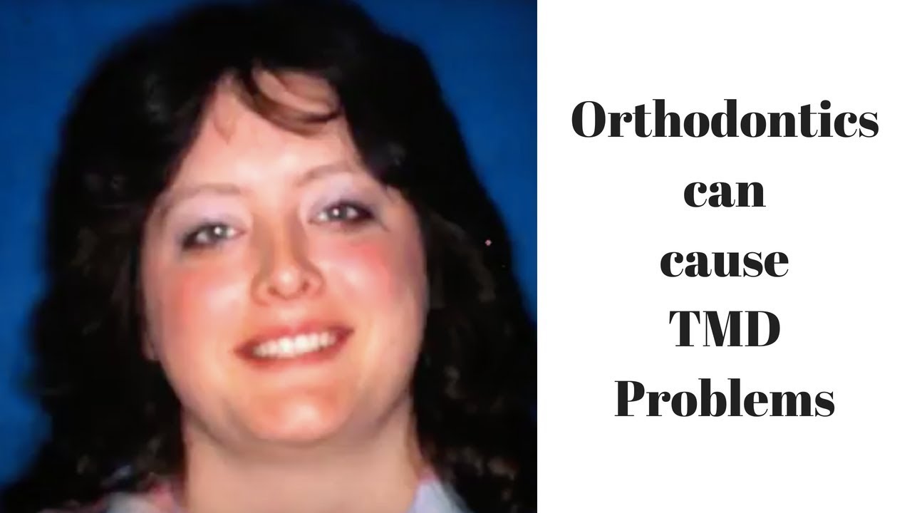 Orthodontics can cause TMD Problems - YouTube