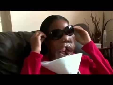 5 Most deformed faces in the world - YouTube